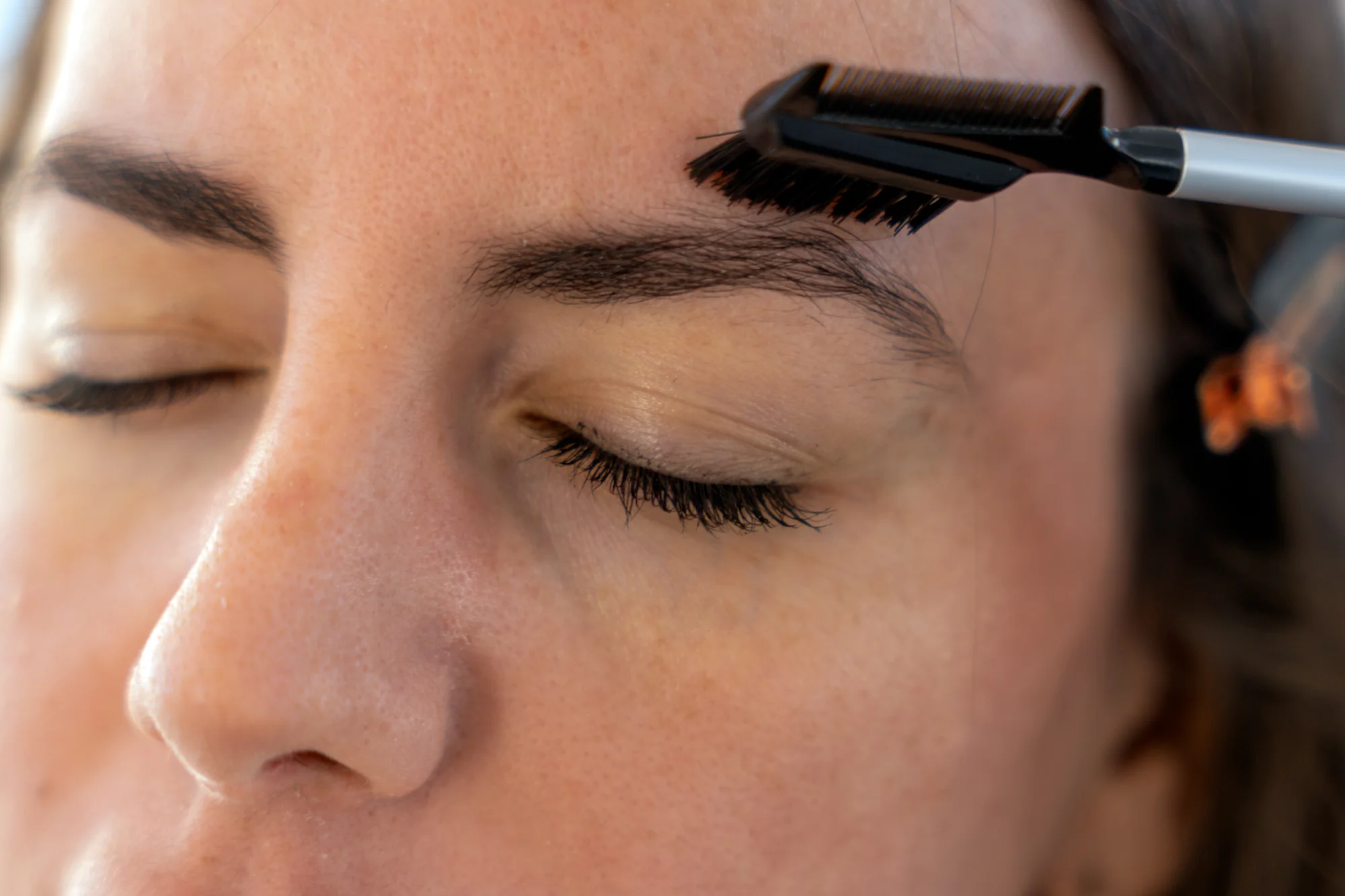 The Secret to Perfectly Shaped Brows: Eyebrow Transplantation Explained ...