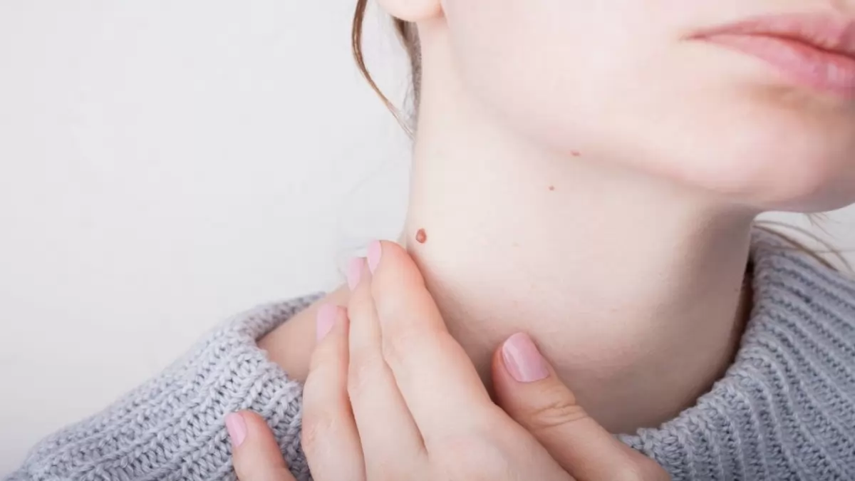 Can You Use Bazuka on Pores and skin Tags? - in2.wales