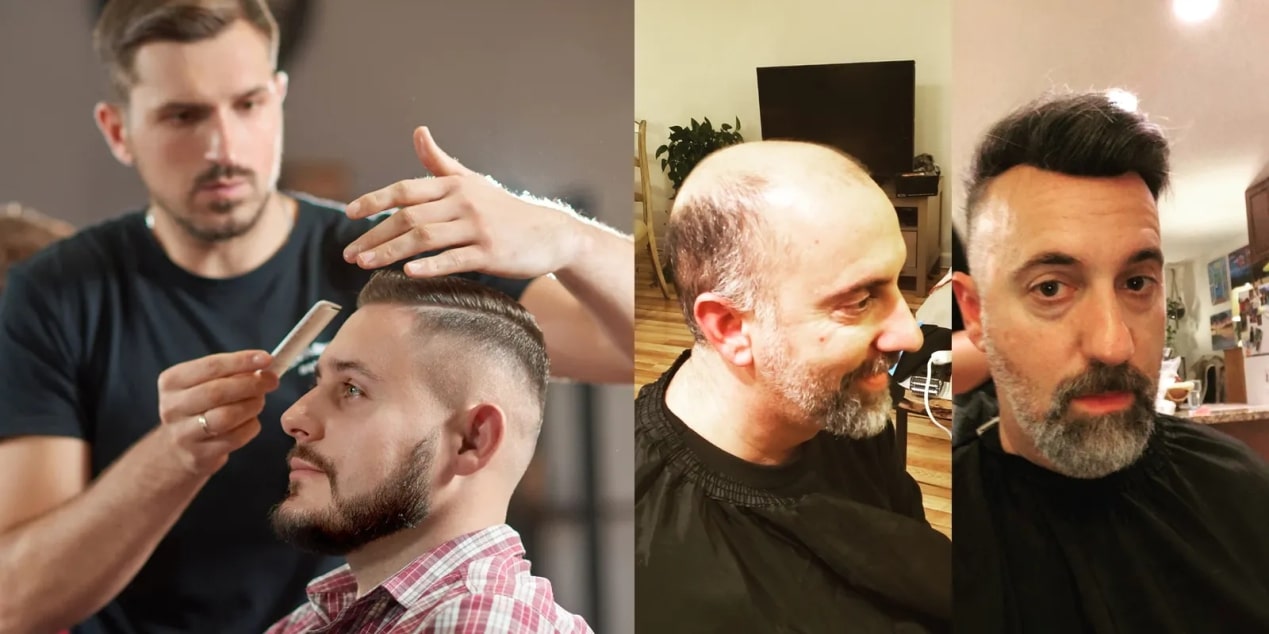 What Is Hair Replacement Service And Where To Find? - The Mews Beauty